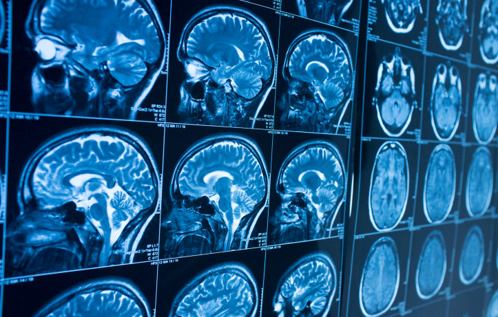 The Value of Early Detection – Find a Psychologist